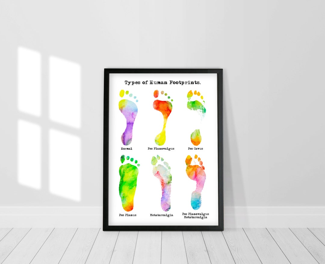 Podiatry Gift Types of Footprints Orthopedics Art Print Physiotherapy ...