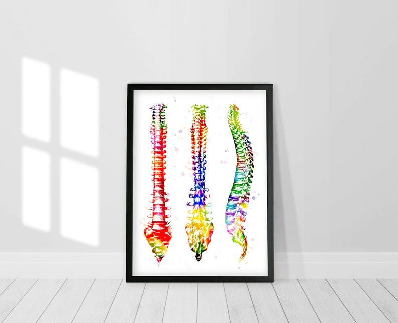 Spine Art Print Human Spine Anatomy Art Medical Poster - Etsy
