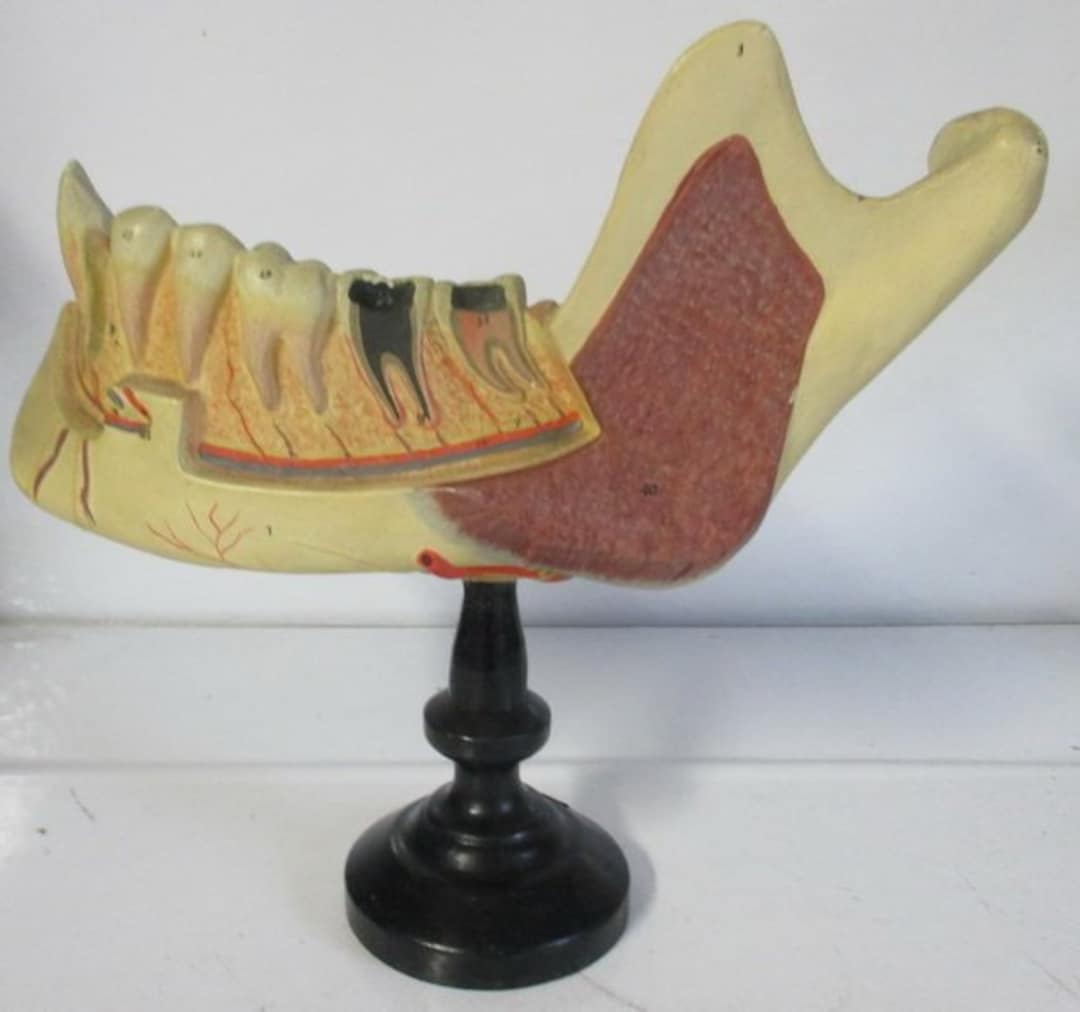 Vintage Didactic Anatomic Model of Teeth on Wooden Base - Etsy