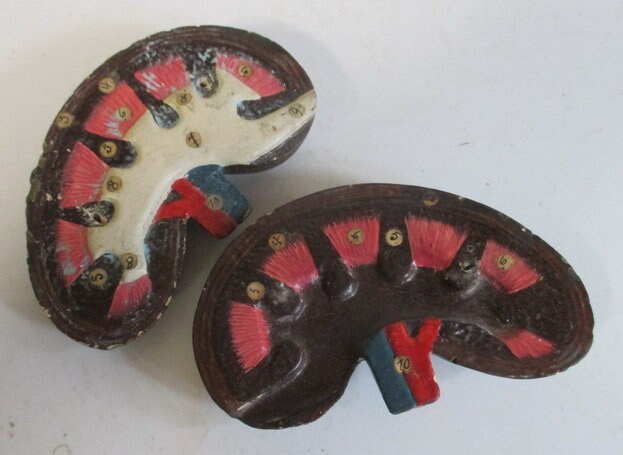 Antique Anatomical Model of an Human Kidney - Etsy