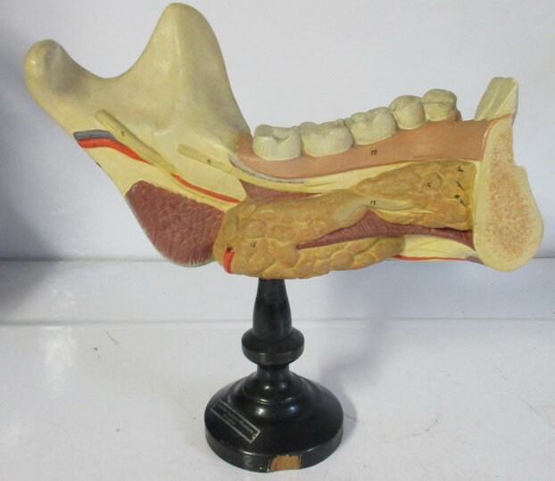 Vintage Didactic Anatomic Model of Teeth on Wooden Base - Etsy