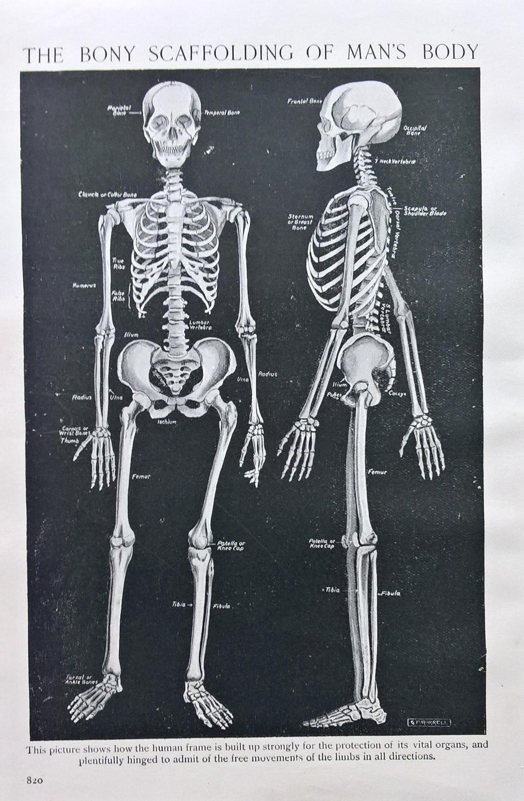 Human Skeleton Antique 1910s Print. Anatomy Medical Gift Present ...