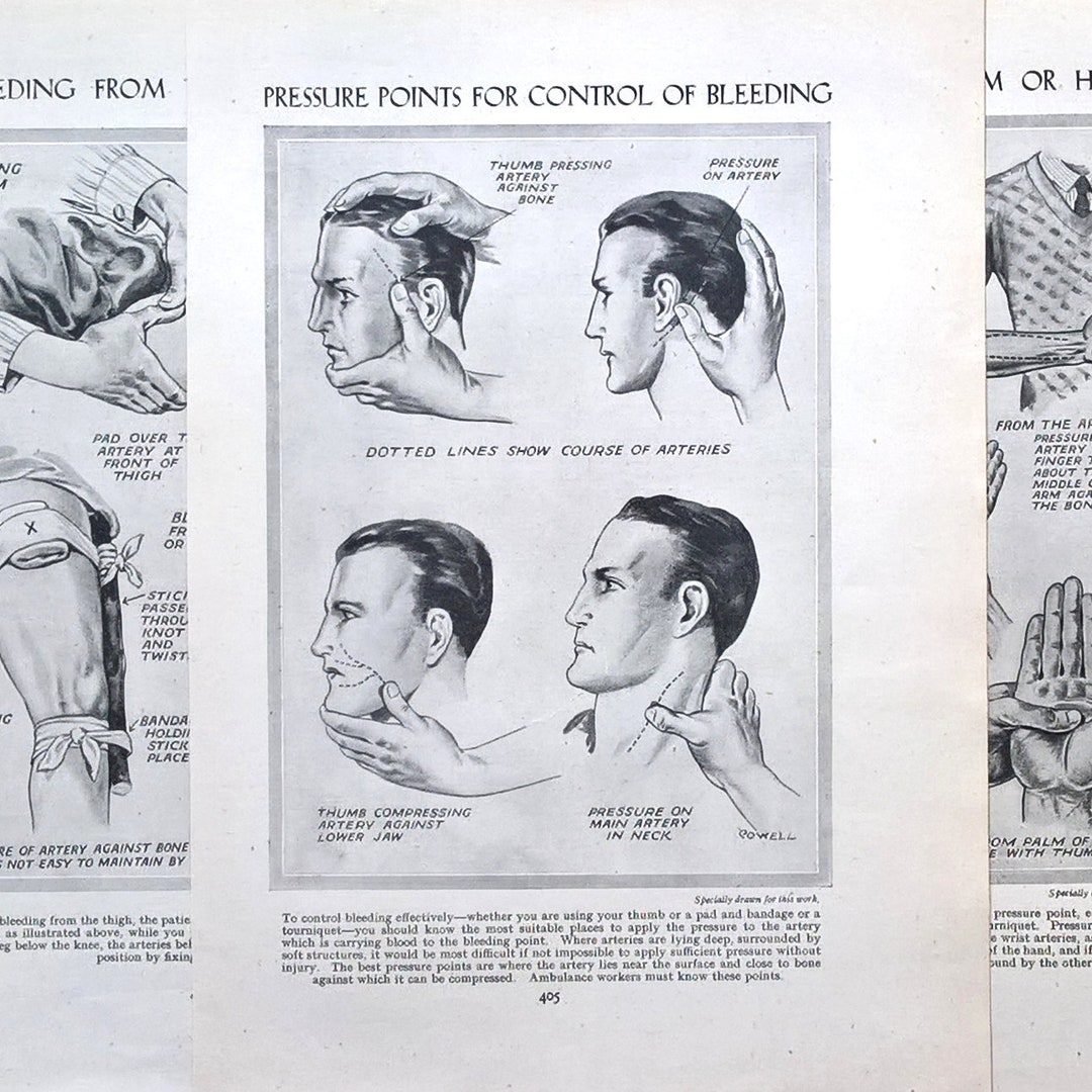3 X Vintage 1940s First Aid Prints. Anatomy Medical Art Artwork. Retro ...