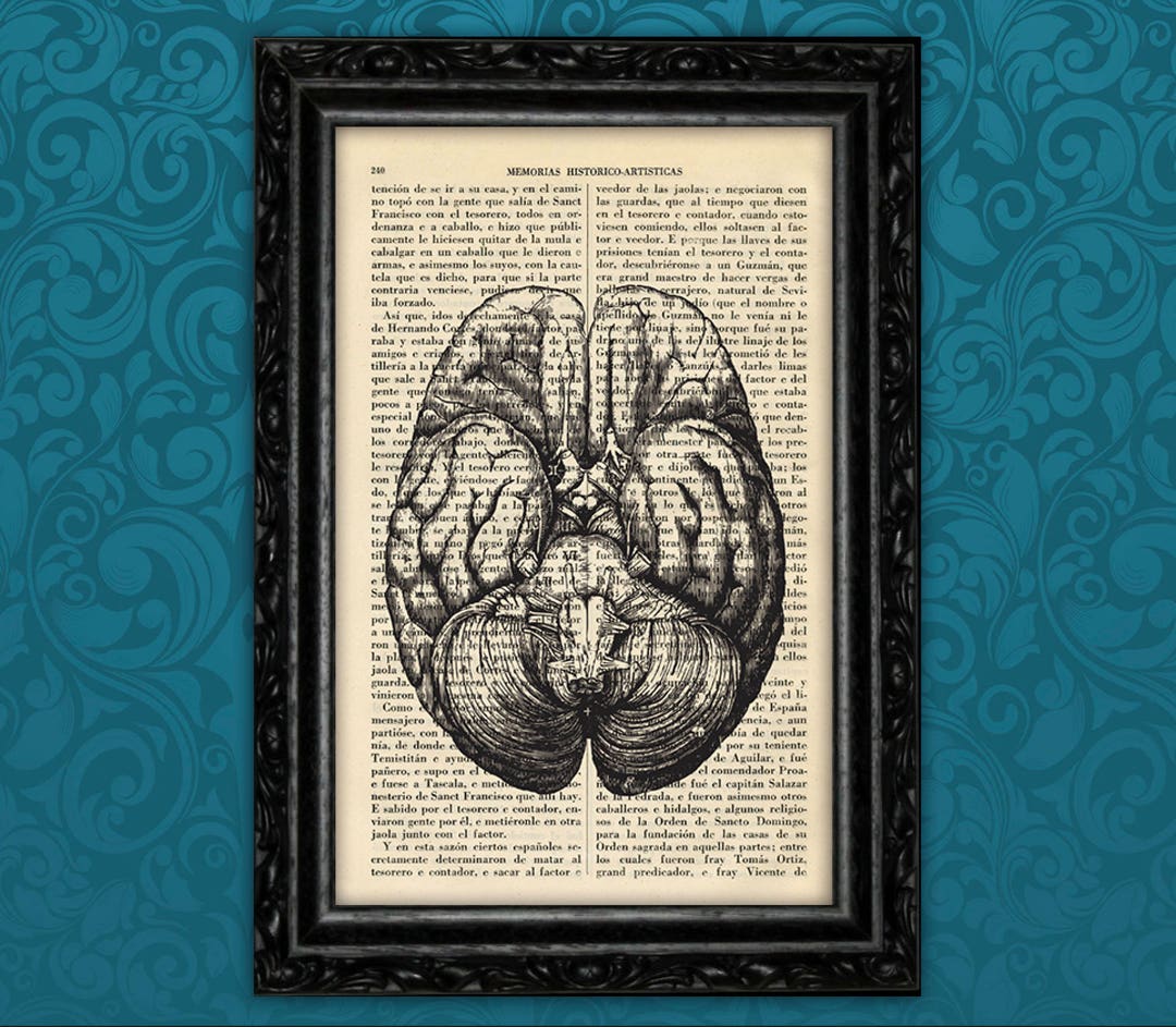 Brain Section Vintage Print Anatomical Print Medical Poster Print Human ...