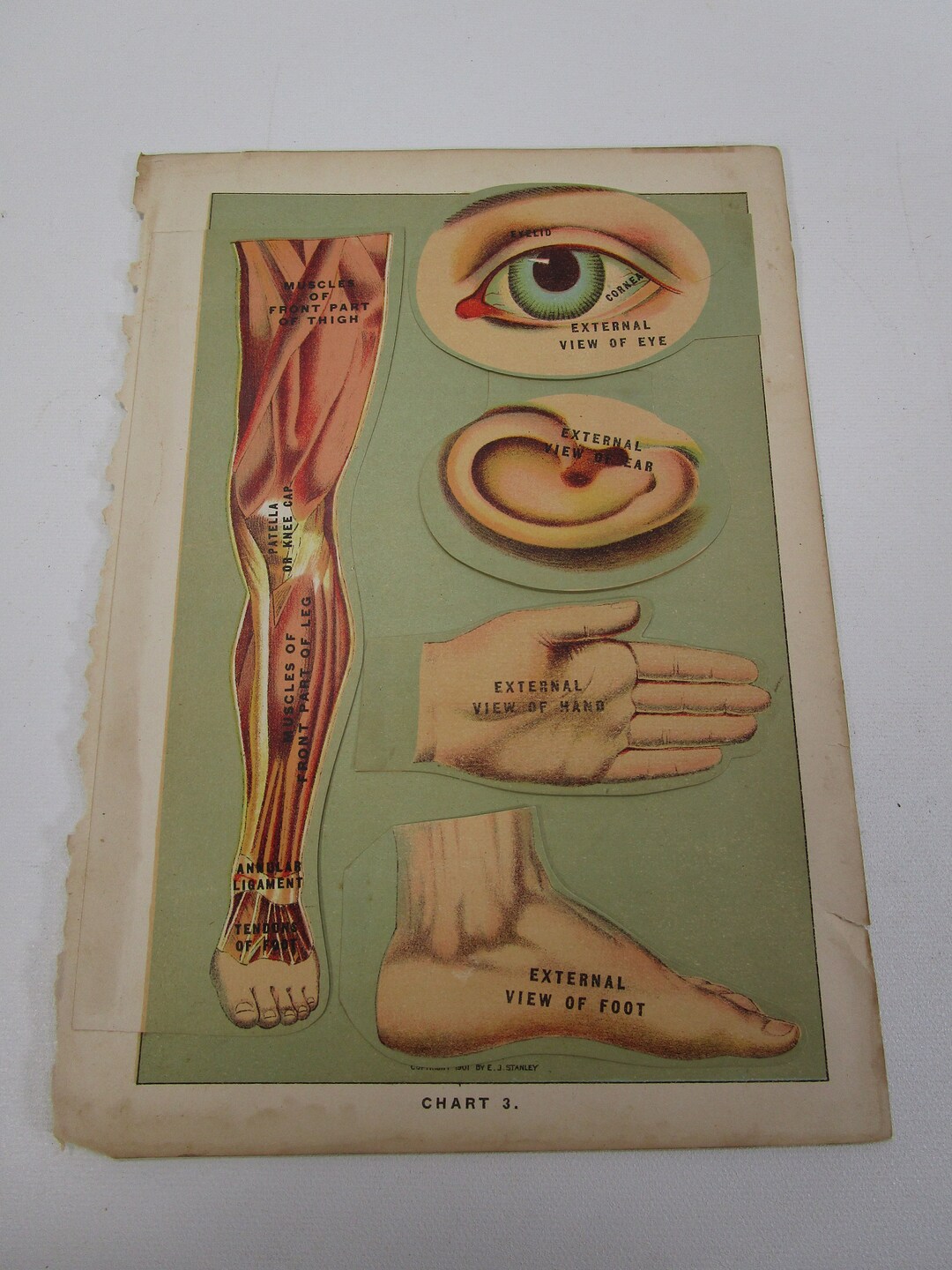 Antique Anatomical Medical Chart Human Arms Limbs Hand Foot EJ Stanley ...