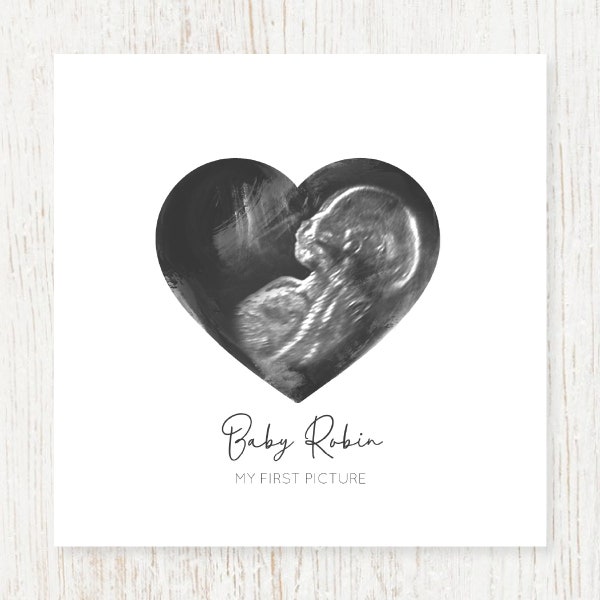 Baby Scan Heart - Etsy