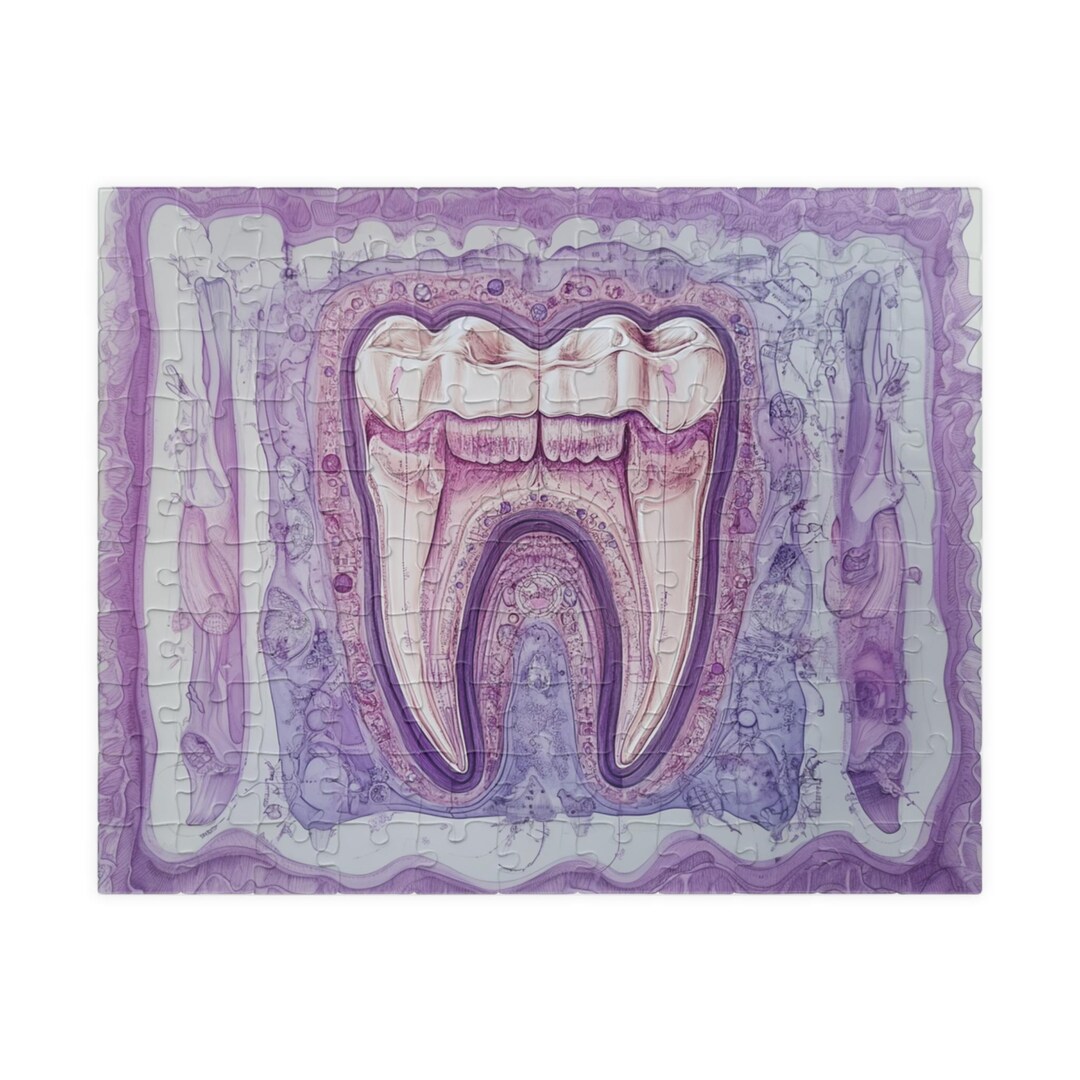 ON SALE, Tooth Anatomy Puzzle (110, 252, 520, 1014-piece) Teeth - Etsy