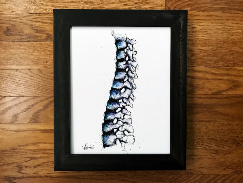 Spine Art - Watercolor and Ink Anatomy Art - Back Vertebrae Wall Art ...