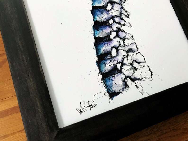 Spine Art - Watercolor and Ink Anatomy Art - Back Vertebrae Wall Art ...