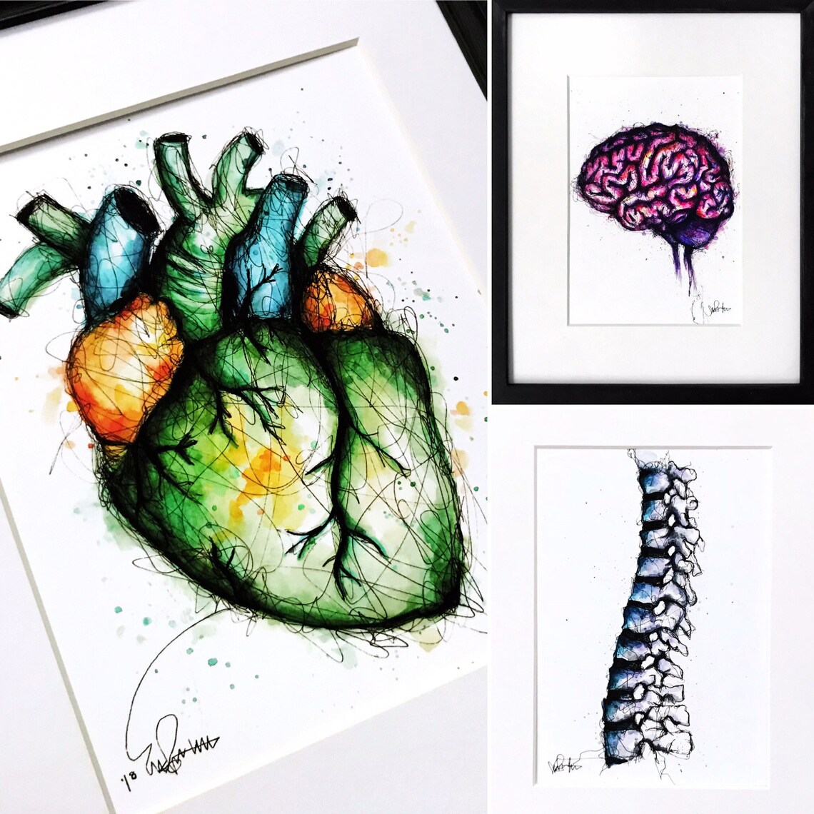 Spine Art - Watercolor and Ink Anatomy Art - Back Vertebrae Wall Art ...