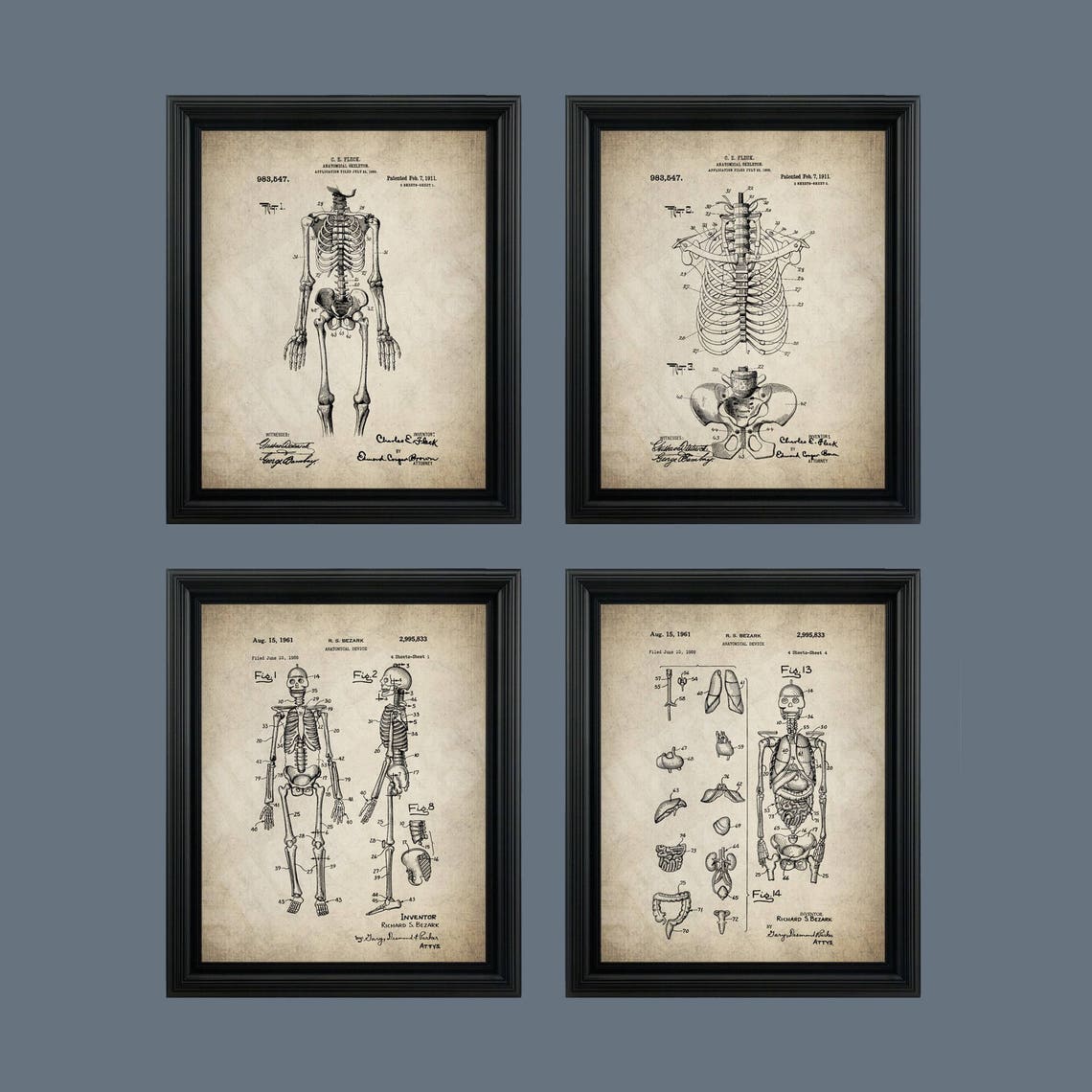 Vintage Skeleton Patent Print - Doctor Gift Medical Art - Skeleton ...
