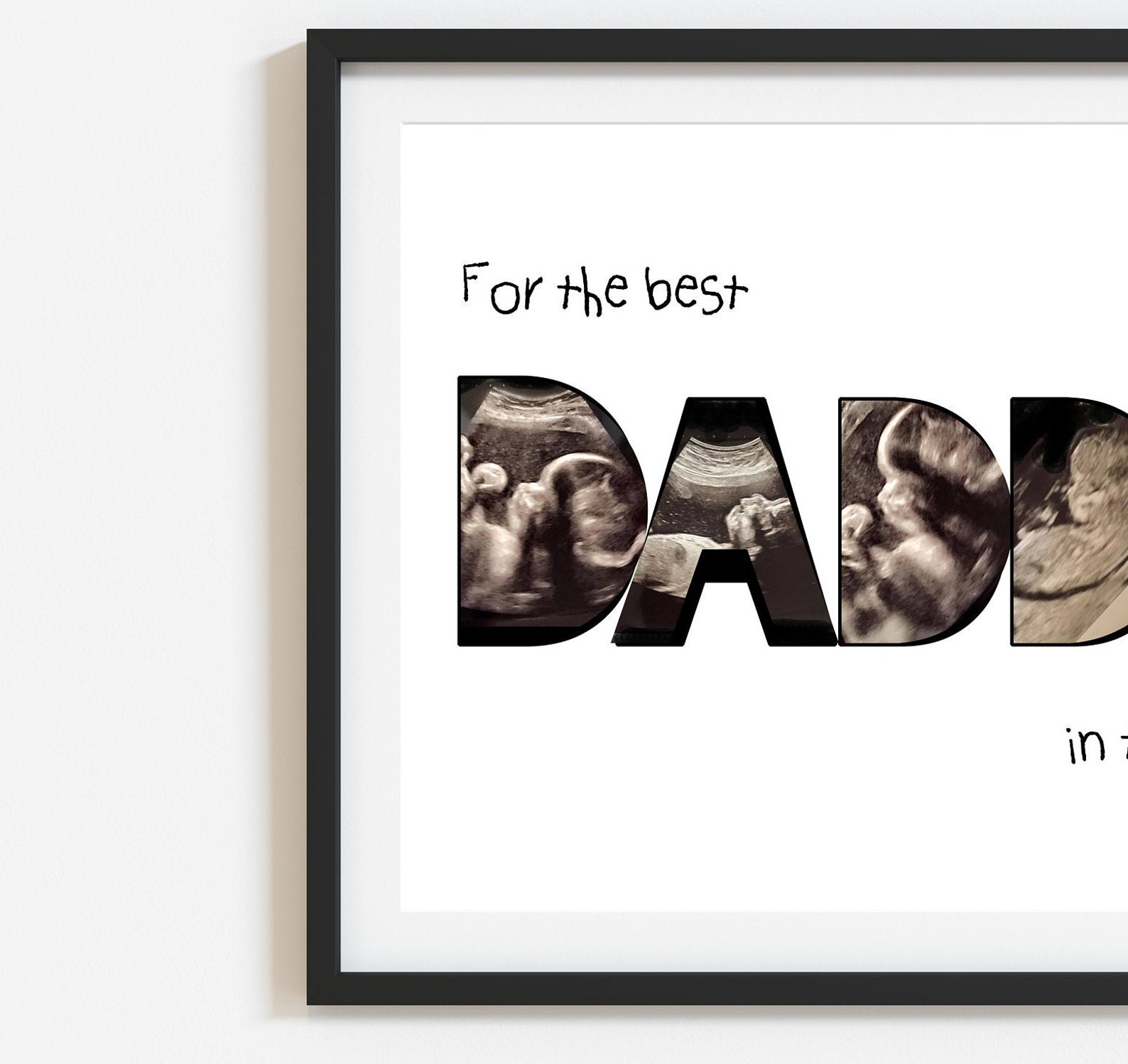 DOWNLOADABLE Baby Scan Keepsake Scan Photo Personalised Baby - Etsy