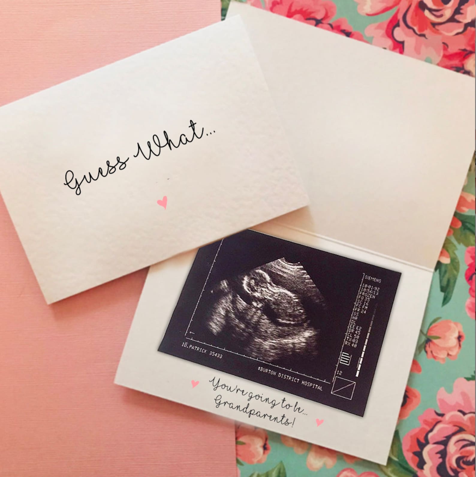 Guess What Pregnancy Announcement Scan Card. You're Going to Be A ...