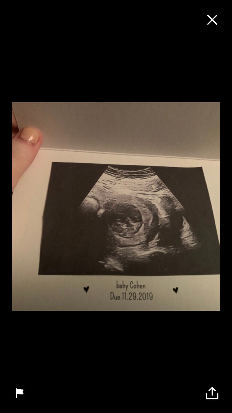 Baby Announcement Pregnancy Scan Photo Card/ Hello Auntie/grandad/nanny ...