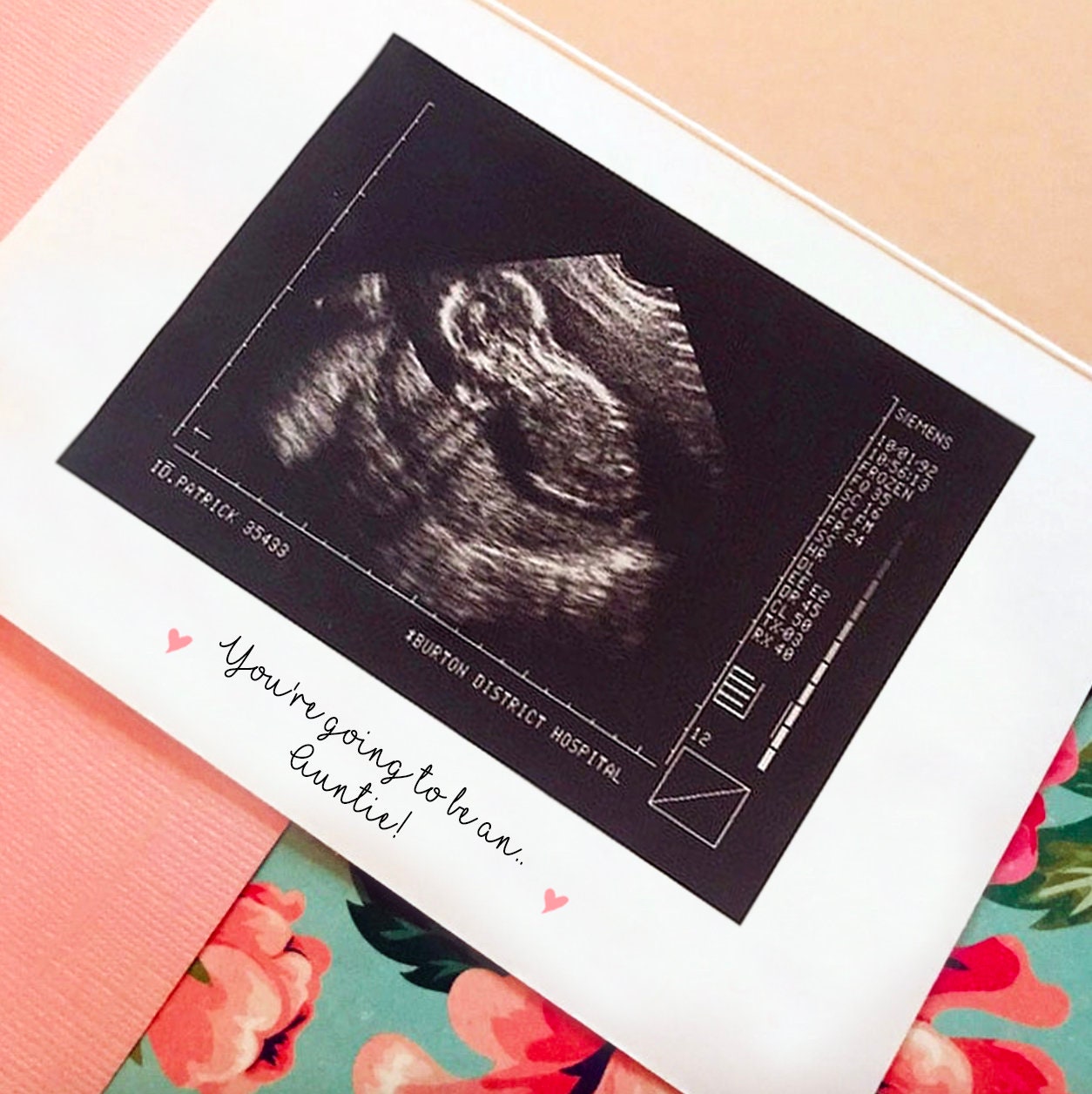 Pregnancy Announcement Scan Card: Surprise Grandparents Card - Etsy
