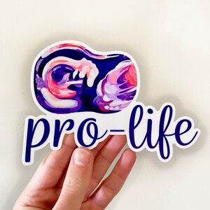 BUMPER STICKER, Pro-life Rainbow Sonogram Ultrasound Art Sticker - Etsy