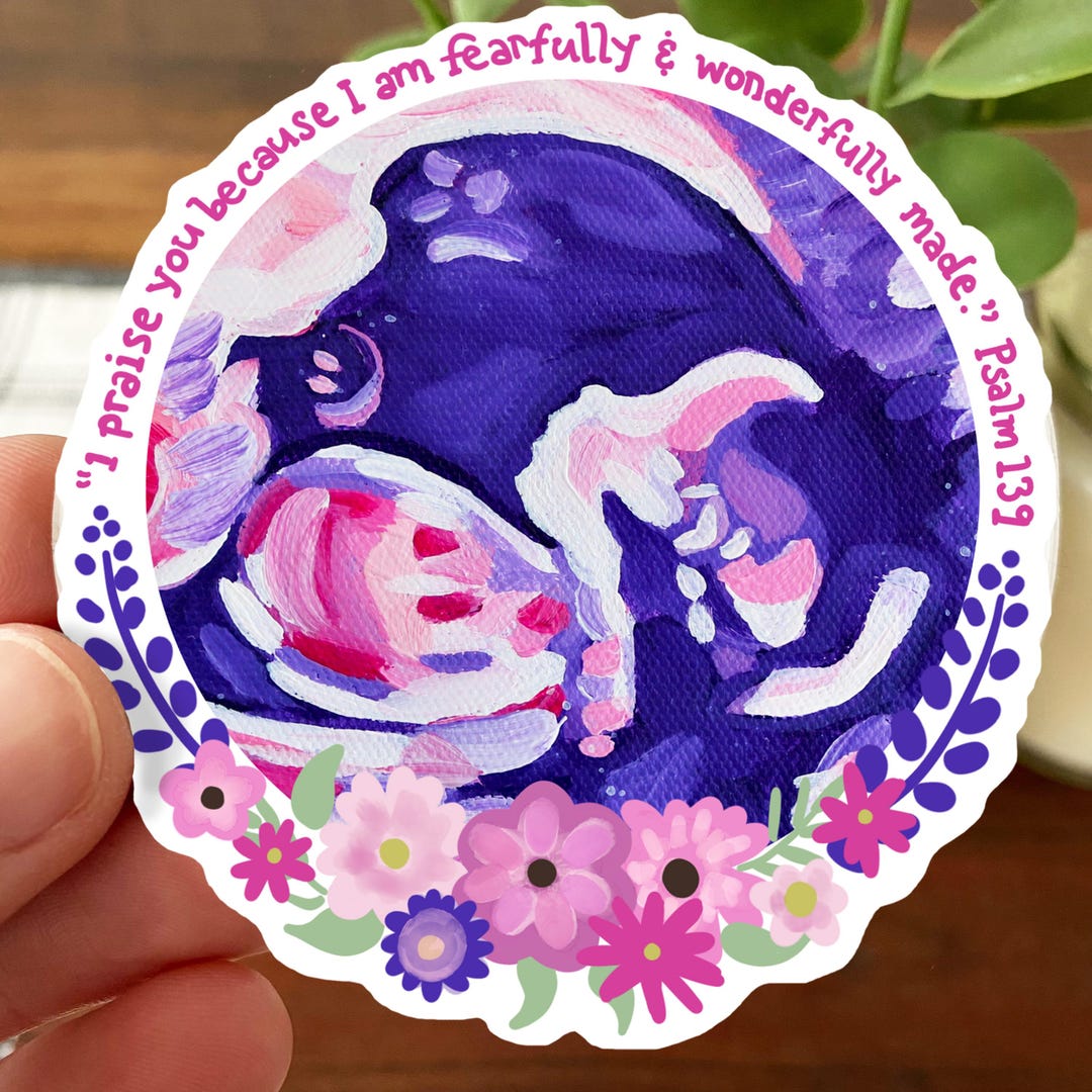 Bulk Ultrasound Art Stickers, Colorful Pro-life Sonogram Designs With ...