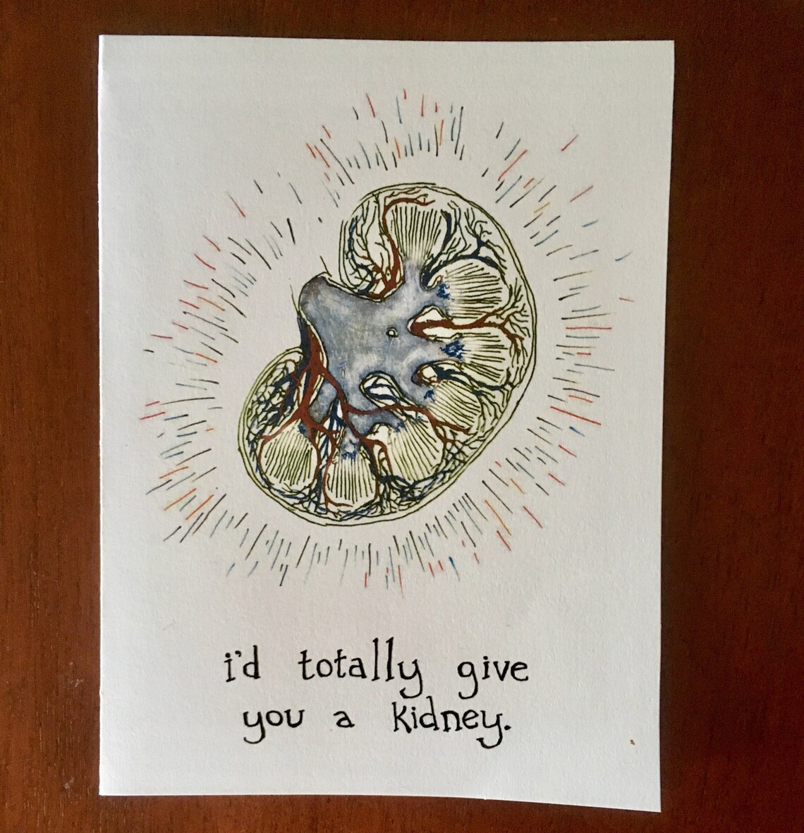I'd Totally Give You A Kidney Card, Love Friendship or Get Well Card - Etsy