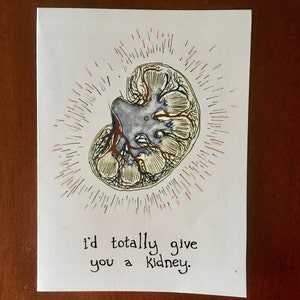 I'd Totally Give You A Kidney Card, Love Friendship or Get Well Card - Etsy