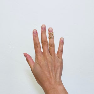 Adjustable Ring for Lateral Deviation, Bending Sideways Finger Splint ...