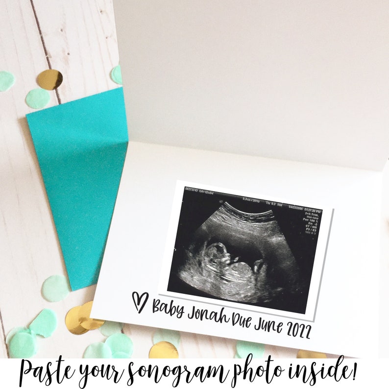 Pregnancy Announcement Card Sonogram Photo Card Ultrasound | Etsy