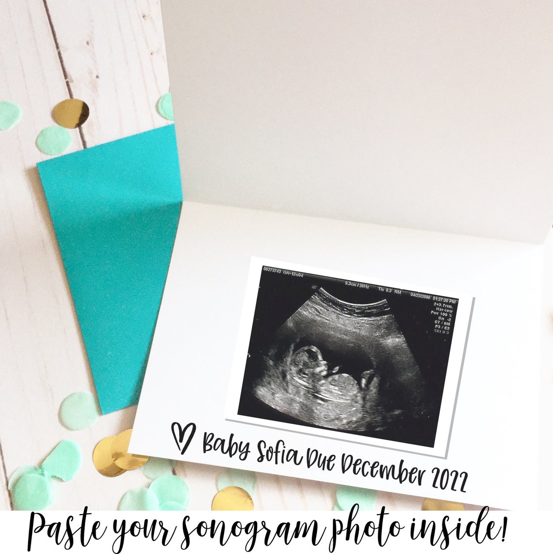 Baby Scan Card New Baby Cards Ultrasound Card Sonogram | Etsy