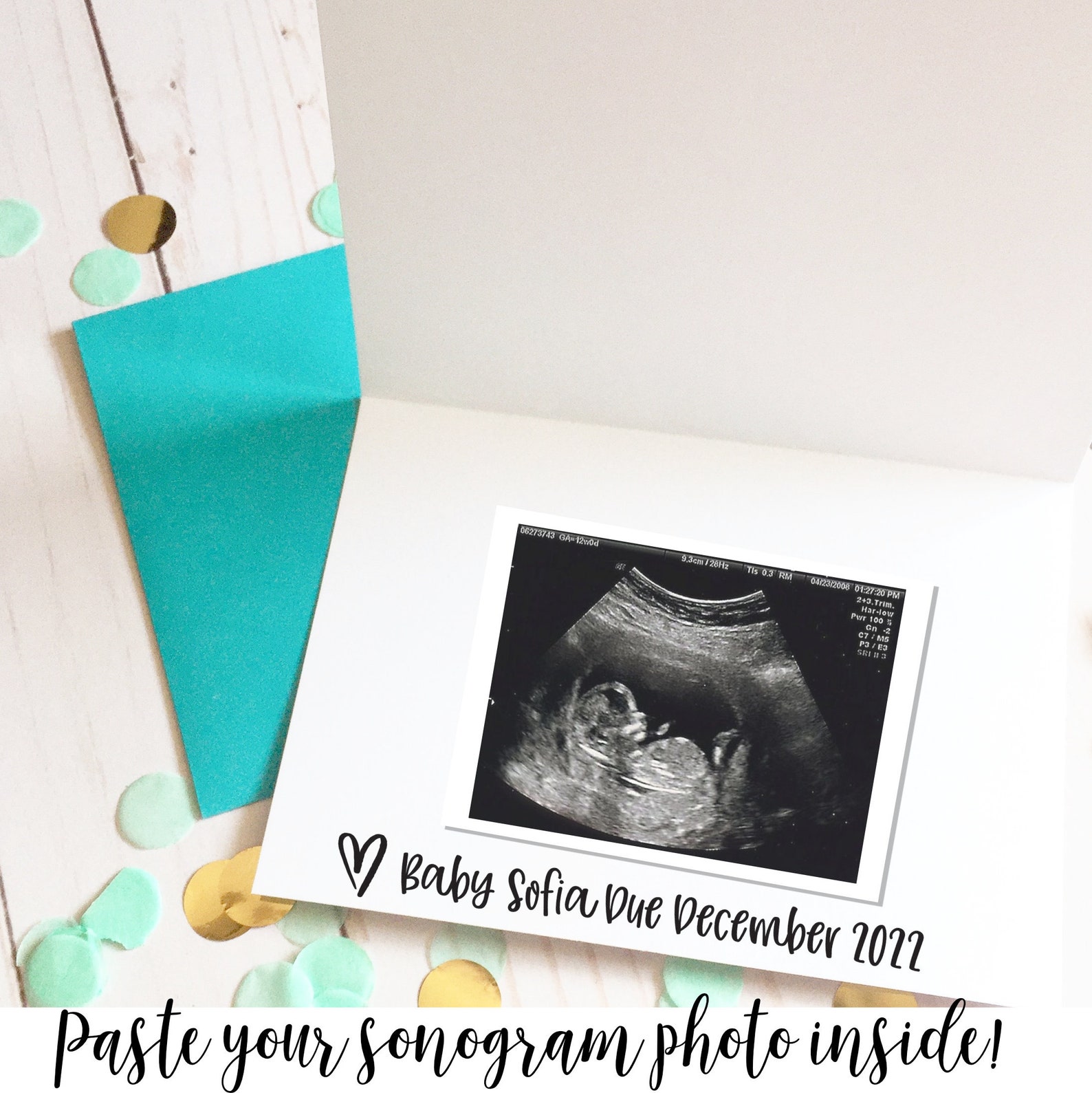 Baby Scan Card New Baby Cards Ultrasound Card Sonogram | Etsy