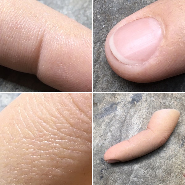 Prosthetic Finger - Etsy