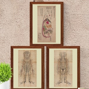 Acupuncture Chart Needle Theraphy - Etsy