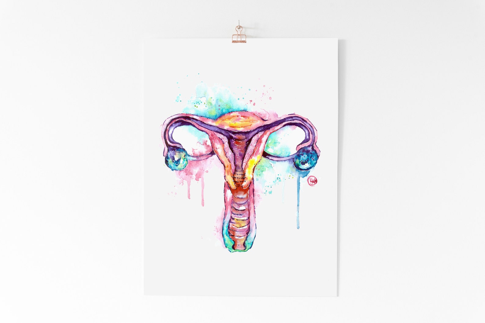 Uterus Art Gynecology Nurse Gift Anatomy Art Medical Art - Etsy