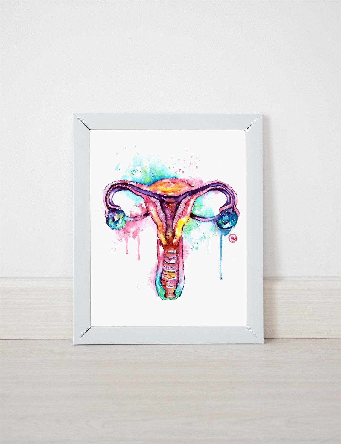 Uterus Art Gynecology Nurse Gift Anatomy Art Medical Art - Etsy