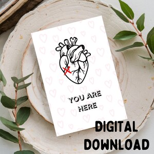 You Are Here- Nurse / Medical Good Luck Greeting Card, Printable ...