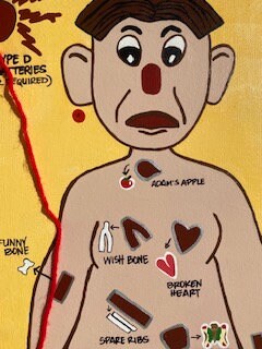 Operation Game Painting - Etsy