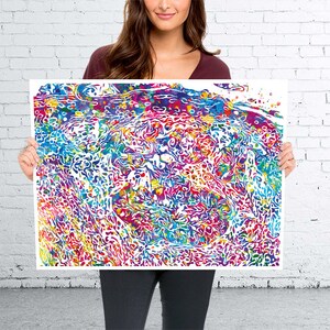 Basal Cell Carcinoma Watercolor Print Skin Histology Science Art ...