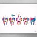 Endodontic Therapy Watercolor Print Root Canal Treatment Tooth Dental ...