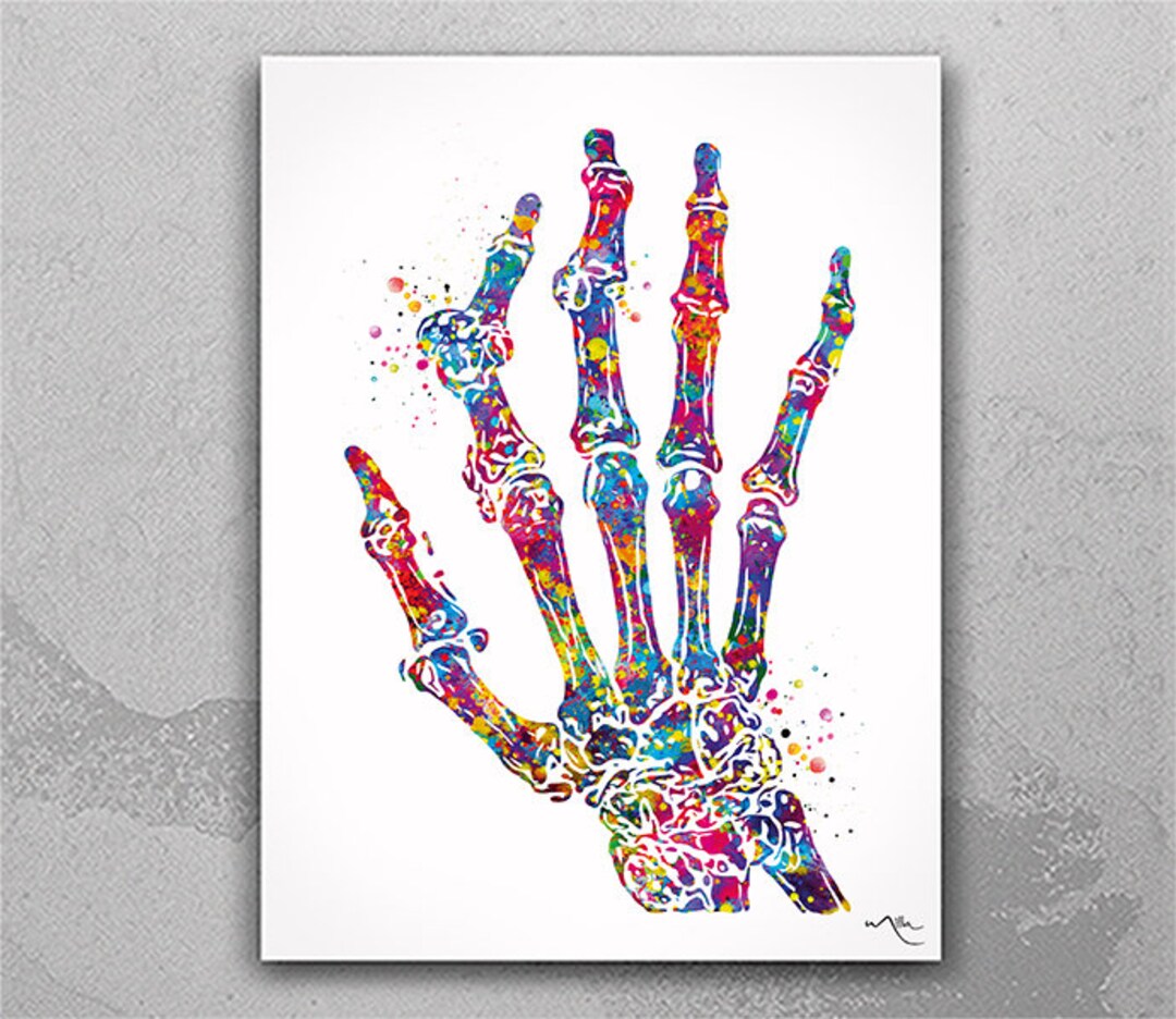 Rheumatoid Arthritis Hand Bone Watercolor Print Carpal Bones Skeletal ...