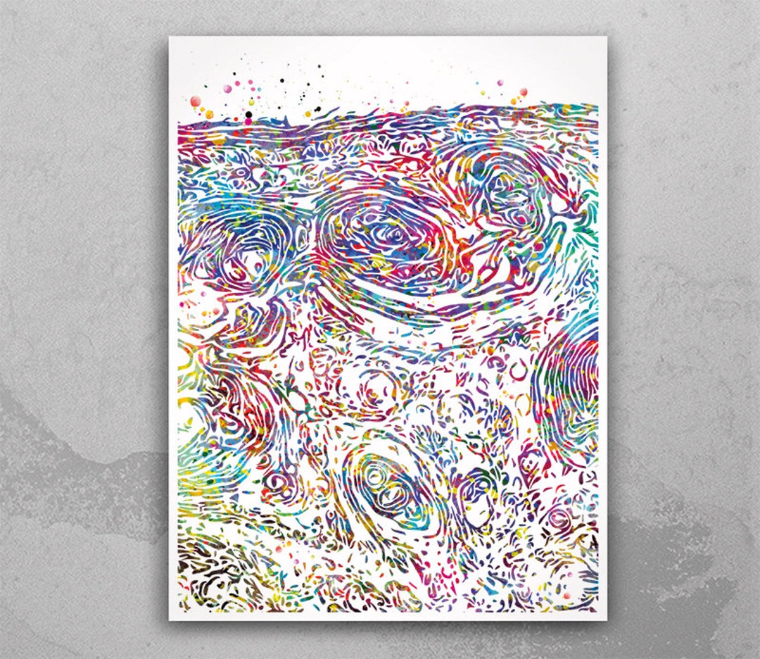 Squamous Cell Carcinoma Watercolor Print, Skin Histology Art-2336 - Etsy