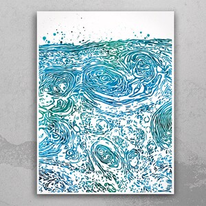 Squamous Cell Carcinoma Watercolor Print, Skin Histology Art-2336 - Etsy