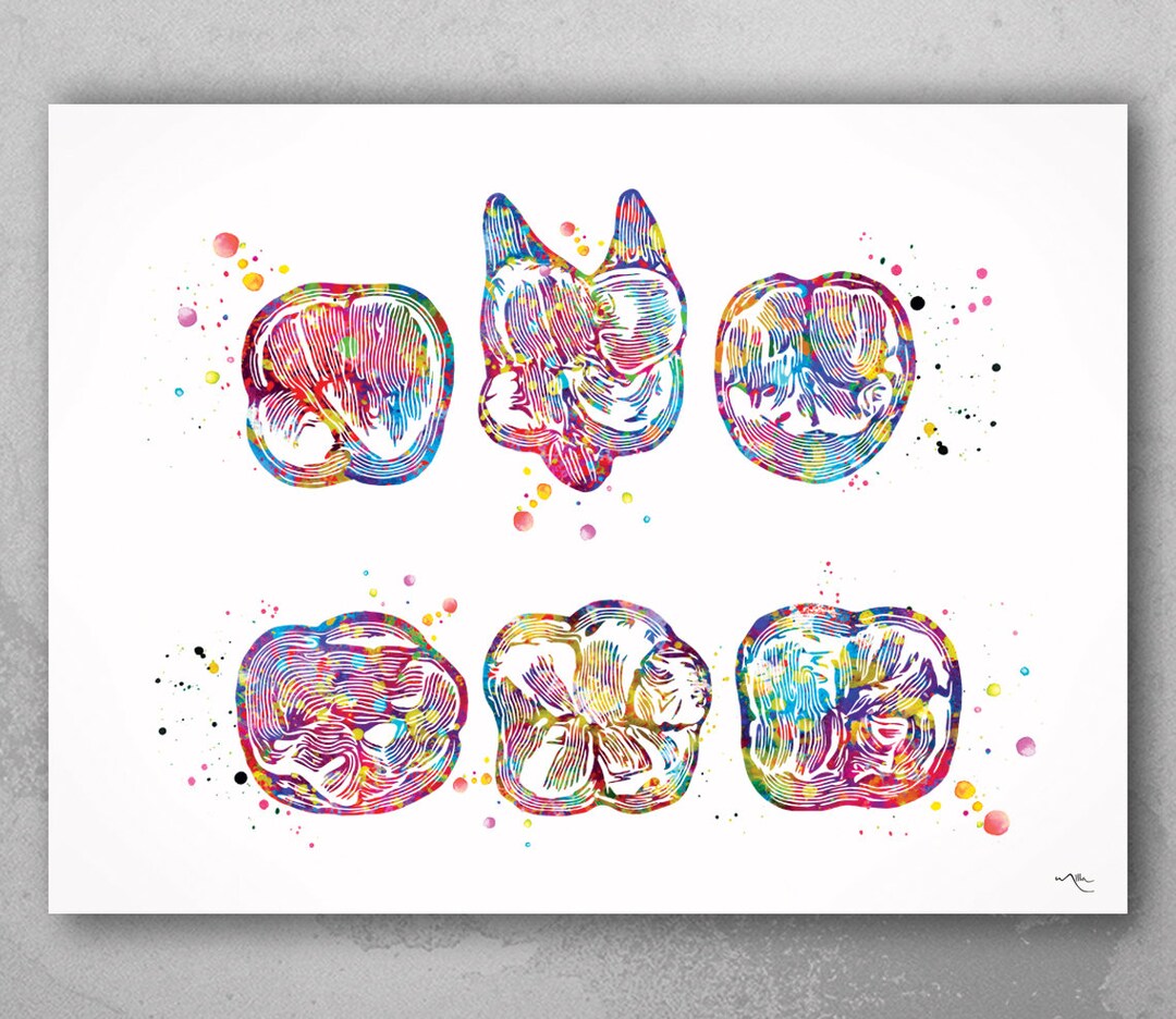 Surfaces Molar Teeth Watercolor Print Human Tooth Anatomical Art Dental ...