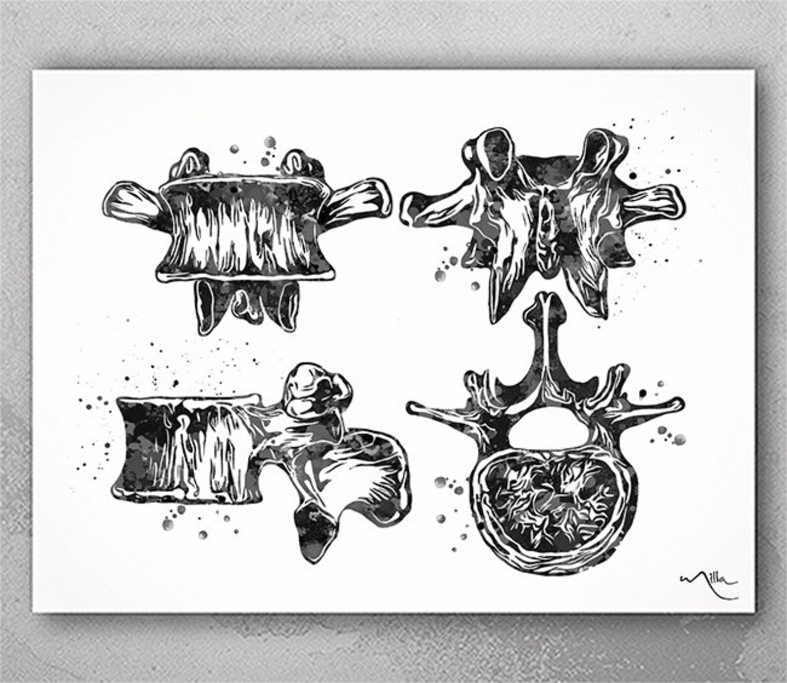 Vertebral Bone Watercolor Print Vertebral Column Cervical Vertebrae ...