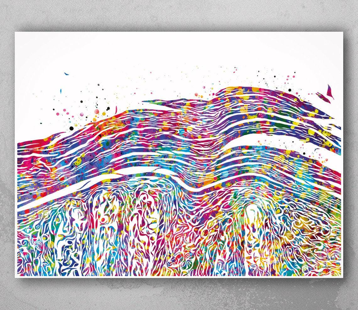 Psoriasis Pathology Watercolor Print: Skin Cell Histology Art-2321 - Etsy