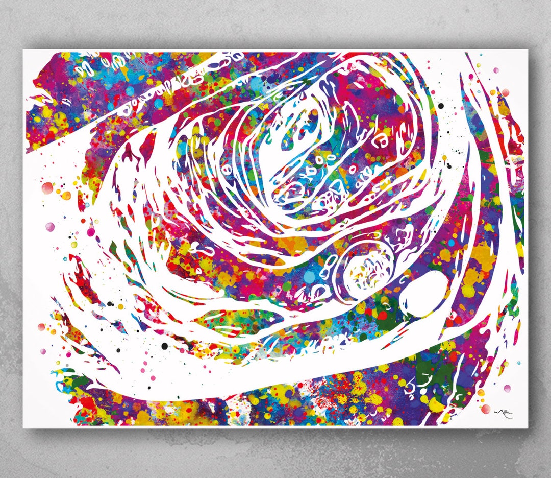 Colonoscopy Watercolor Print Science Art Cancer Histology ...