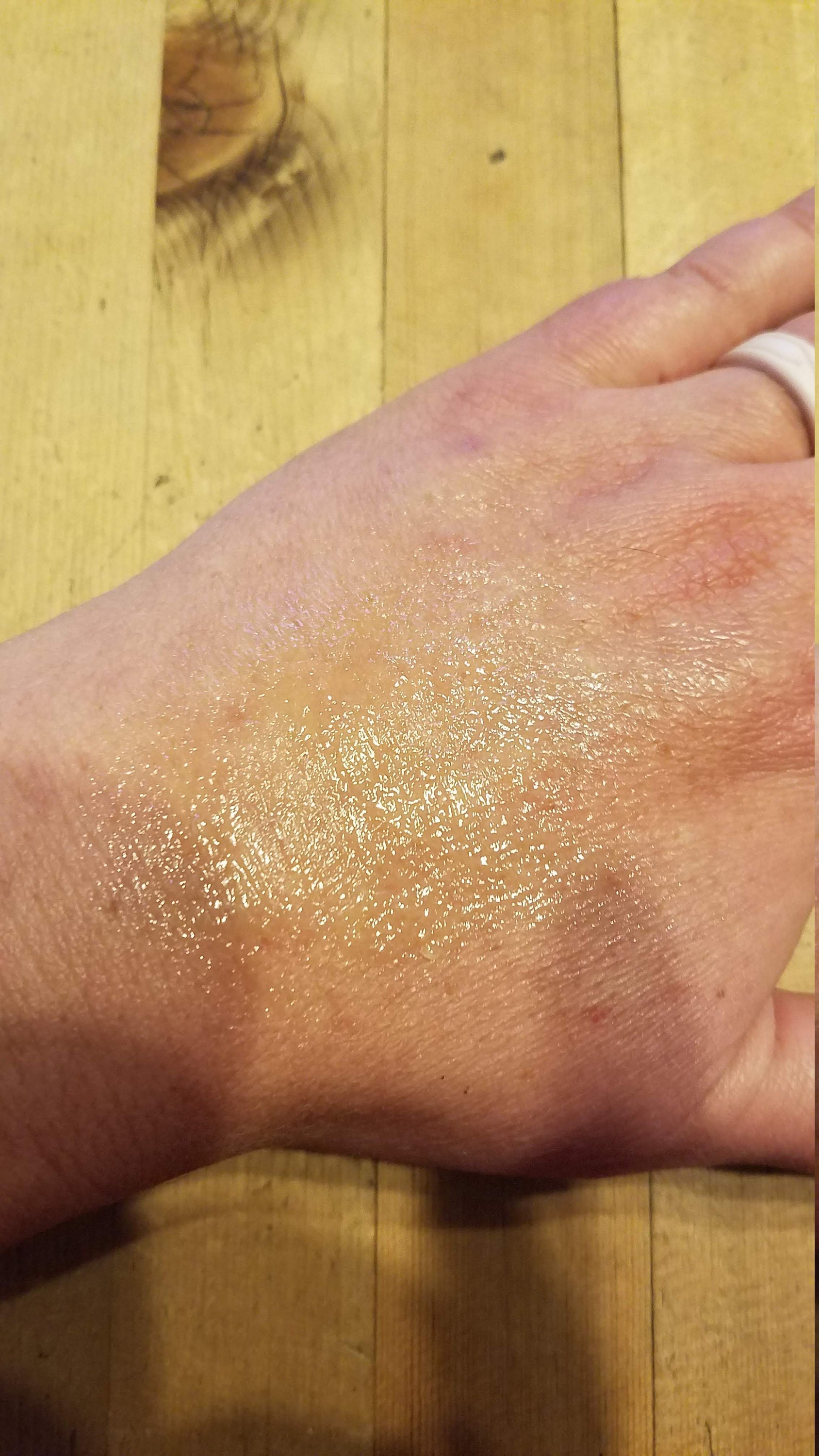 Healing Pinon Salve - All Natural Skin Lotion - Hand Made in Colorado ...