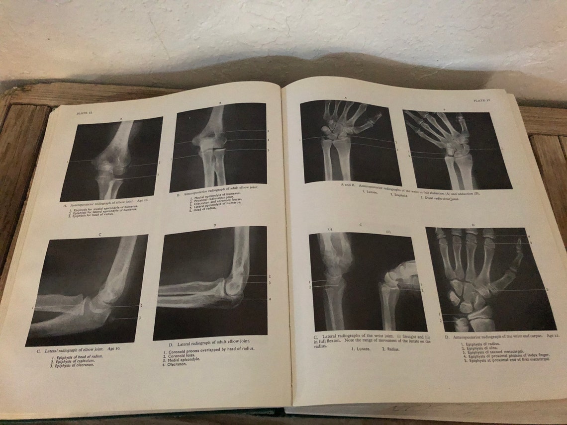 Vintage Book Titled Cunningham's Textbook of Anatomy Oxford University ...