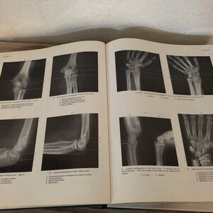 Vintage Book Titled Cunningham's Textbook of Anatomy Oxford University ...