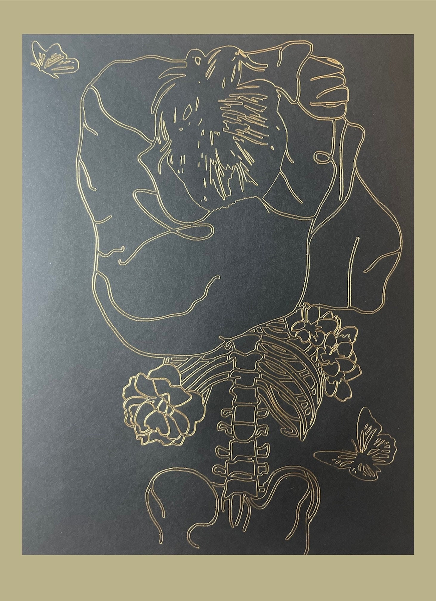 Dysmorphia Large Art Print | 8.5X11 | Mental Health Body Dysmorphia ...