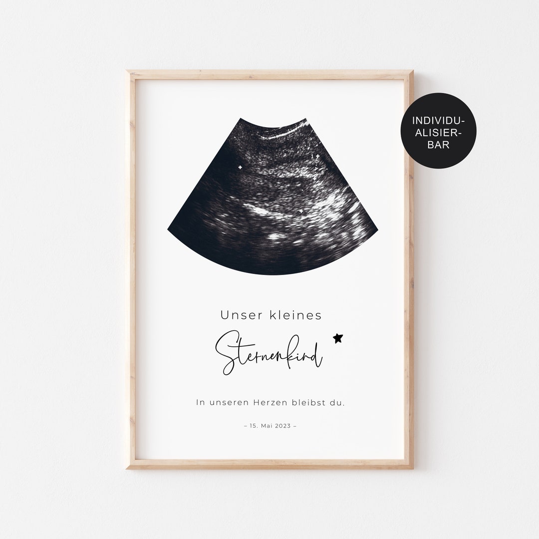 Star Child Memory Poster Personalized With Ultrasound Image: Keepsake ...