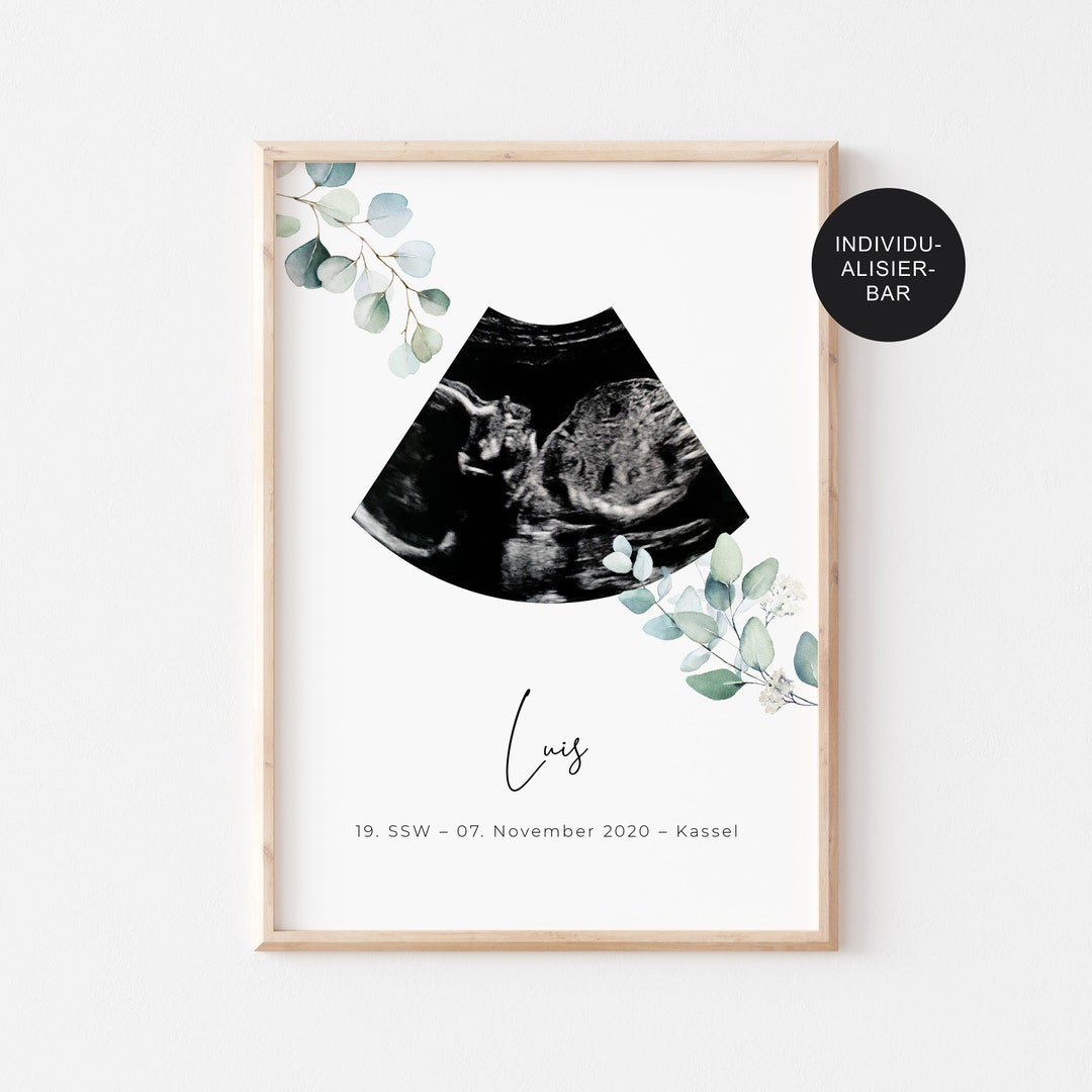 Personalized Ultrasound Poster eucalyptus Pregnancy Announcement Gift ...