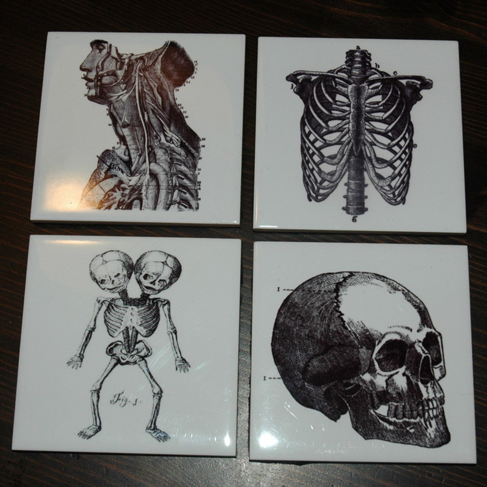 Vintage Anatomy Ceramic Printed Coaster Set of 4 Dark Decor - Etsy