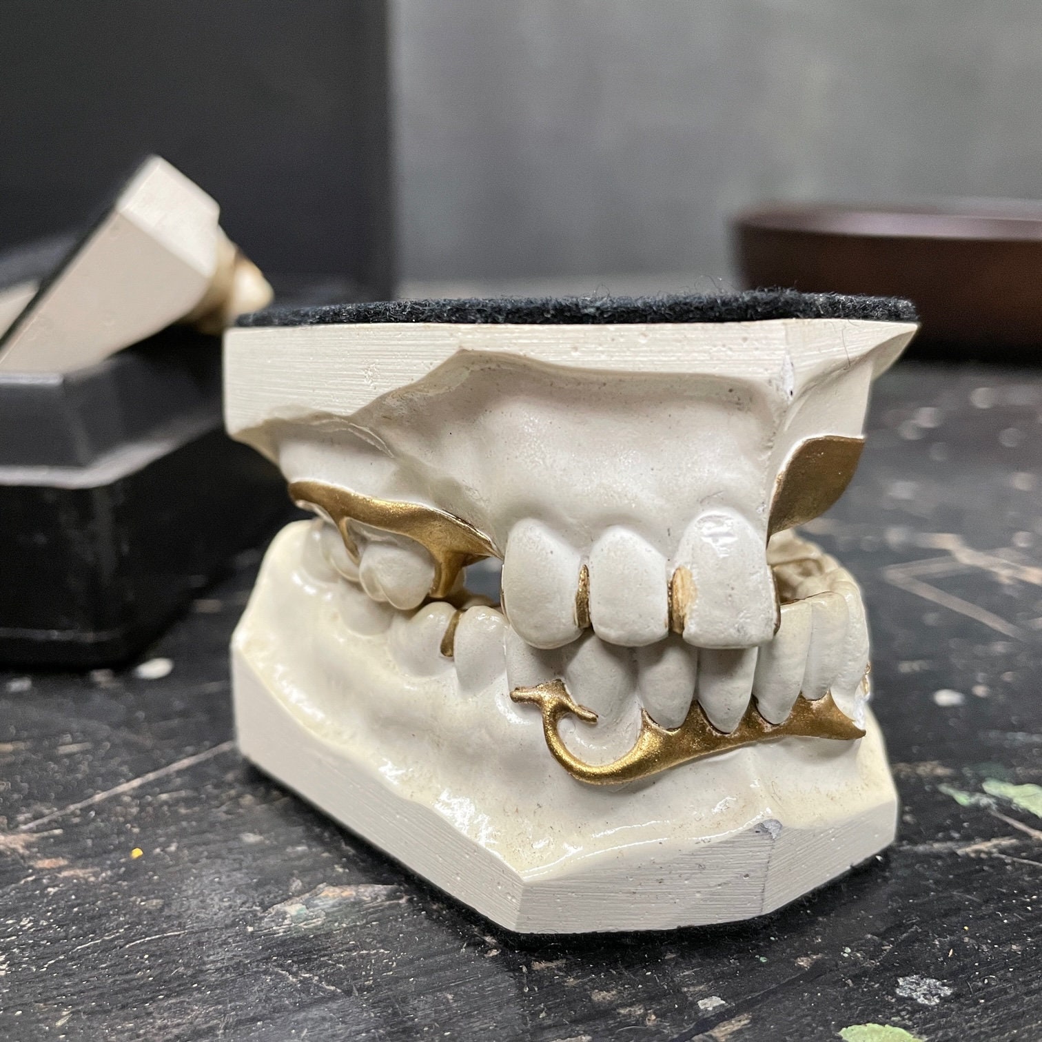 Gold Tooth Bridge